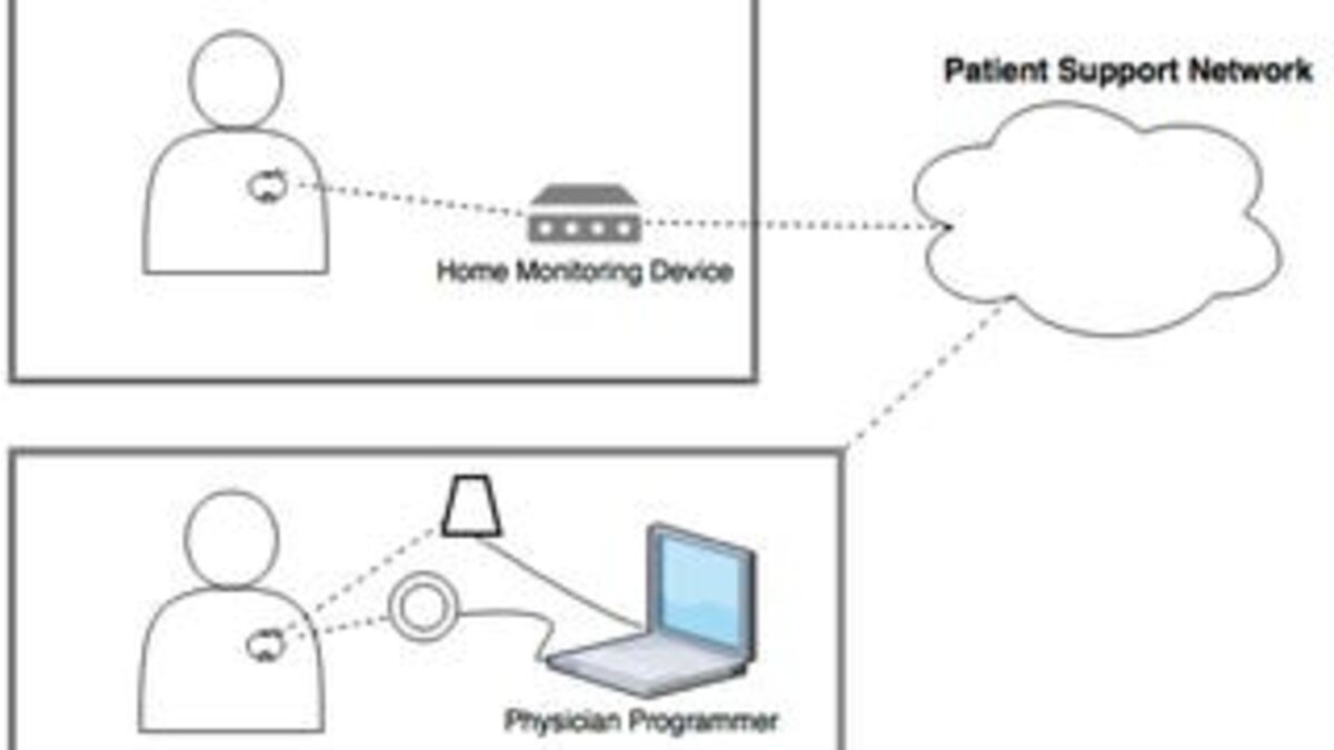 Pacemakers have thousands of vulnerabilities hackers can exploit, study ...
