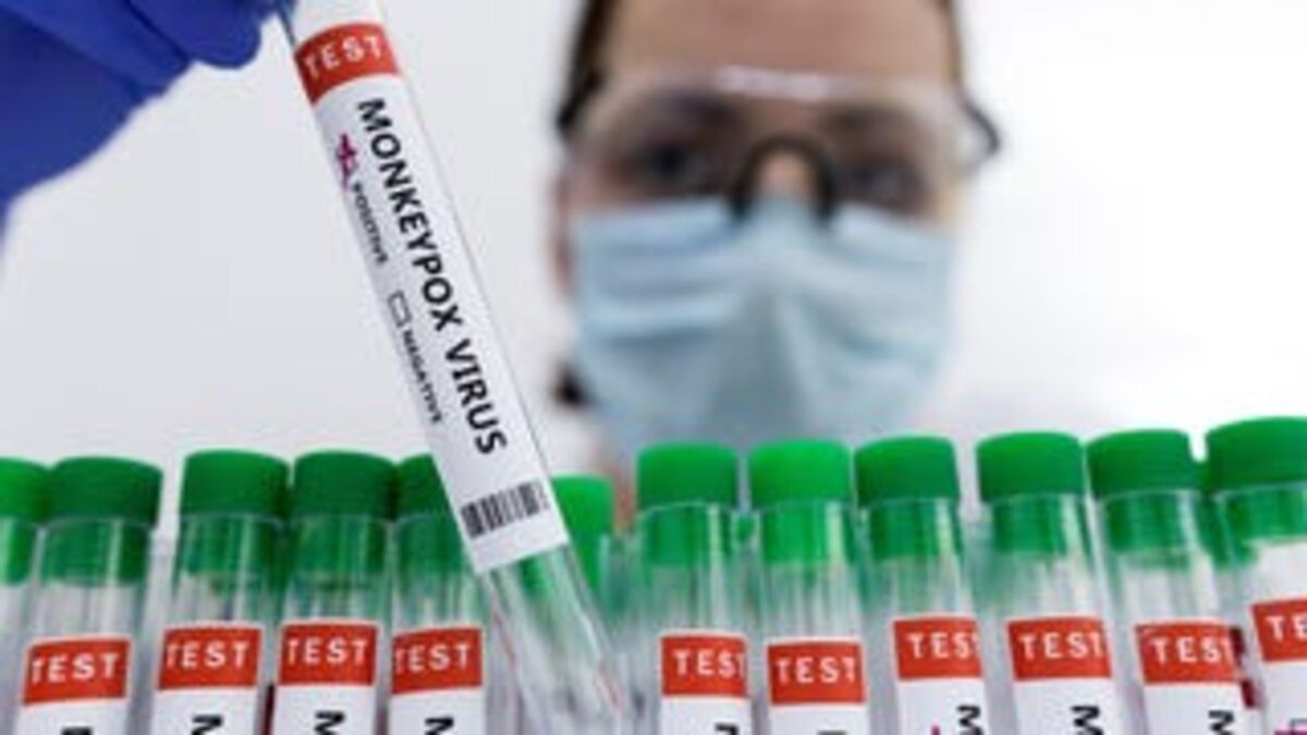 How do we test for monkeypox?