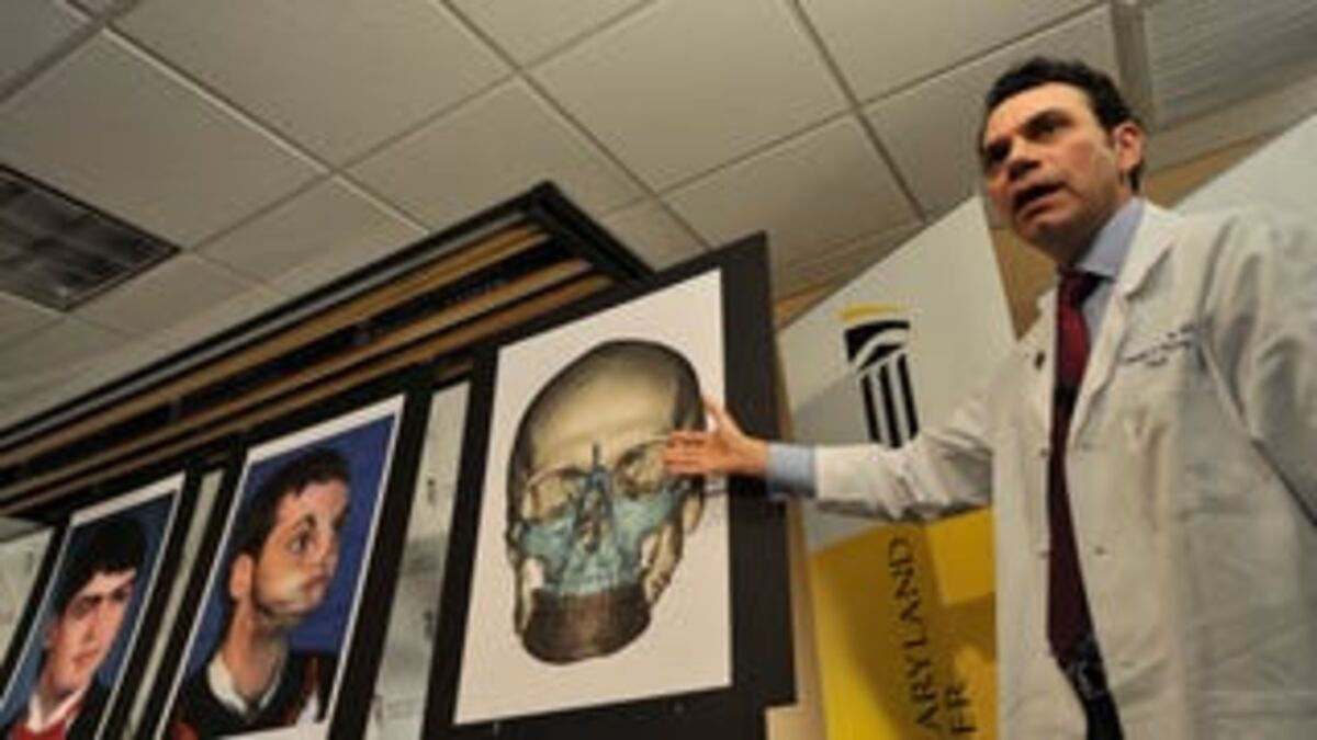 First-ever human head transplant is now possible, says neuroscientist