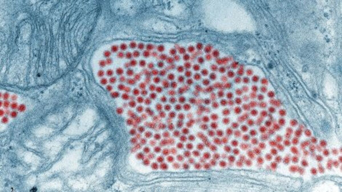 Mosquitoes Are Spreading a Rare, Brain-Infecting Virus in Florida