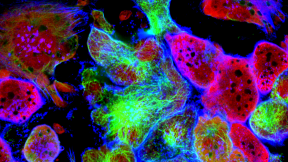 Two-Thirds of All Cancer Mutations Are Unavoidable, Scientists Claim