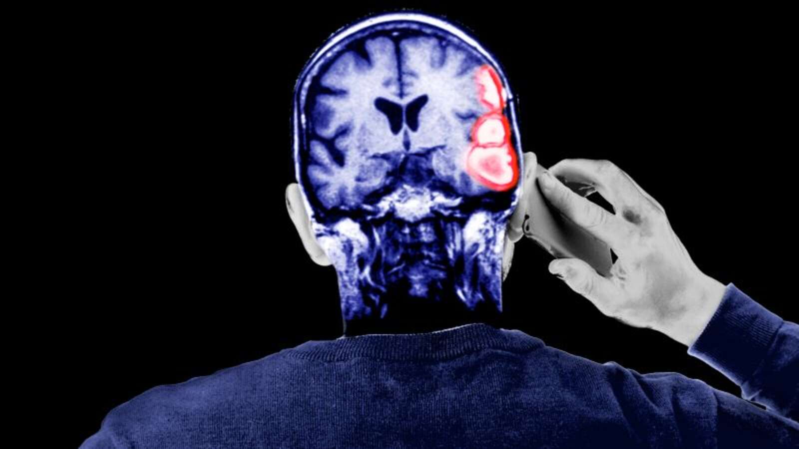 What to Do If You Think You're Having a Stroke