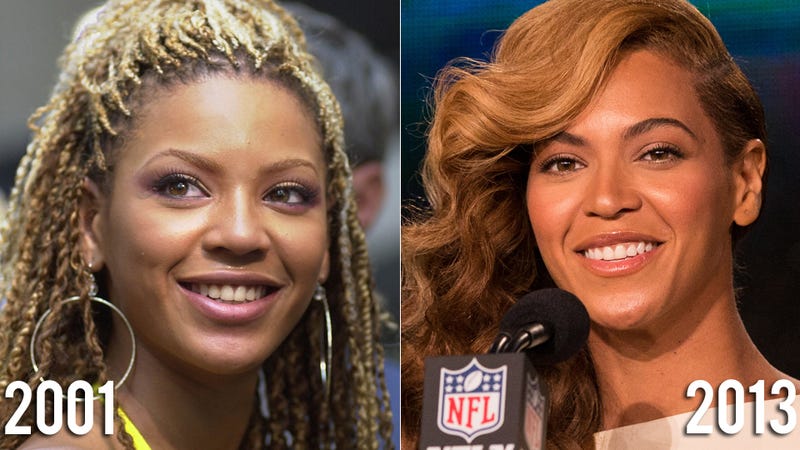 When Did Beyoncé Get a Nose Job?