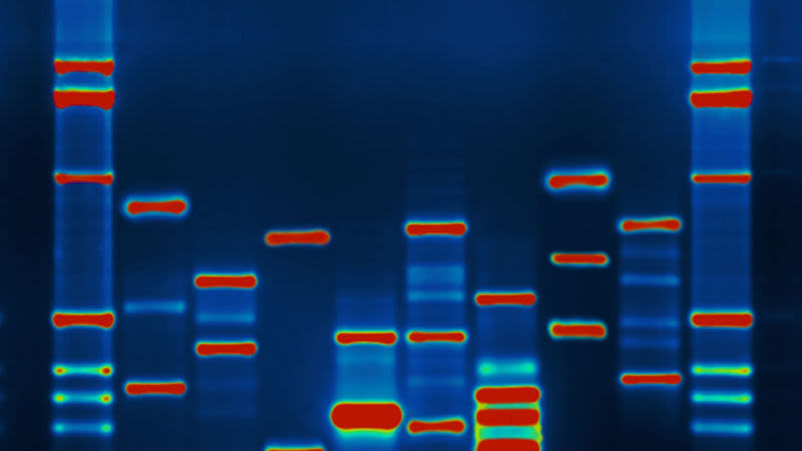 In a Major First, Scientists Edit DNA Within the Human Body In a Major First, Scientists Edit DNA Within the Human Body