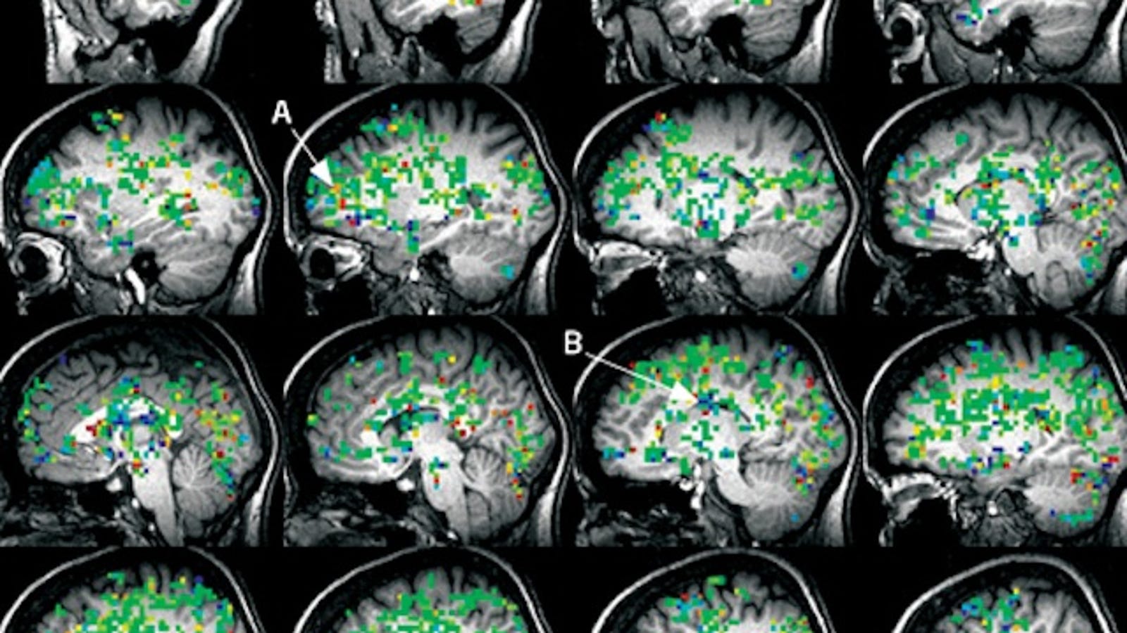 This Is What Your Brain Looks Like When You Masturbate