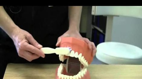 What to Buy When You’re Getting Invisalign