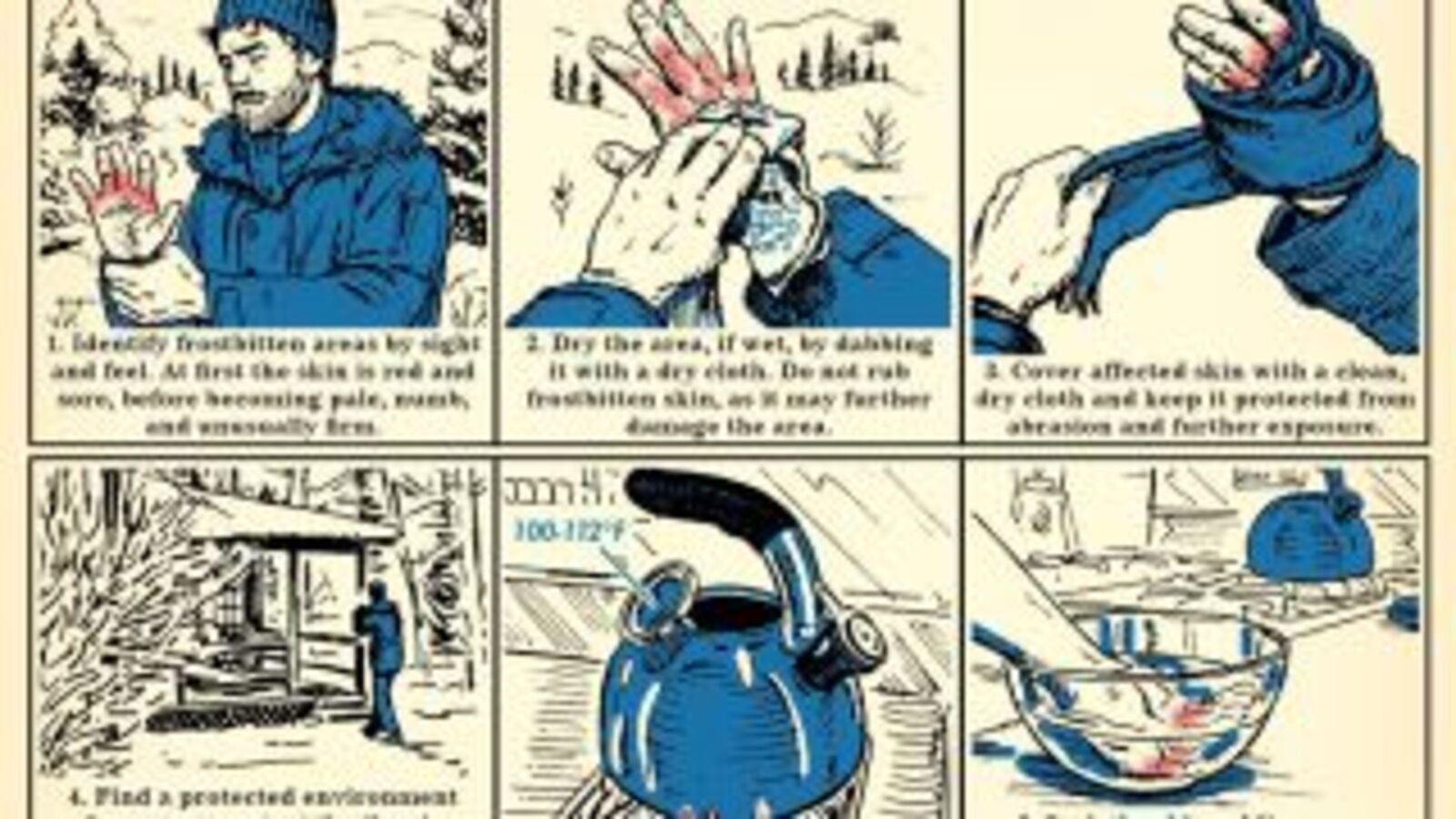 This Graphic Shows You How to Treat Frostbite