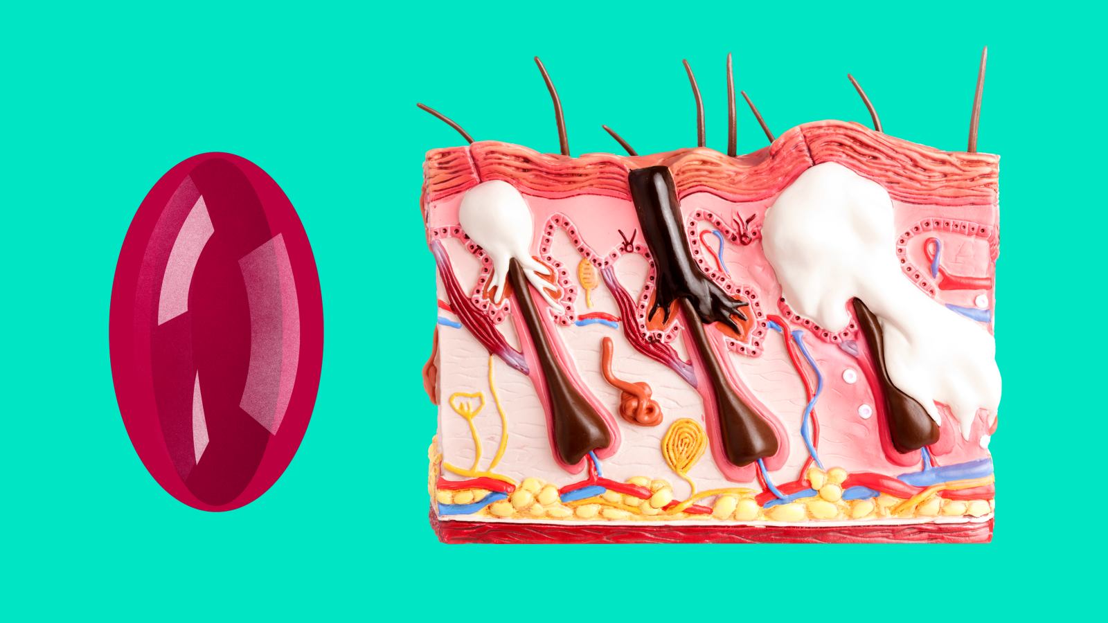 Everything You Need to Know About Starting Accutane