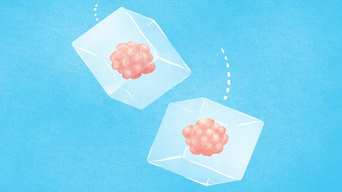 You Can Freeze Your Fat and Poop It Out